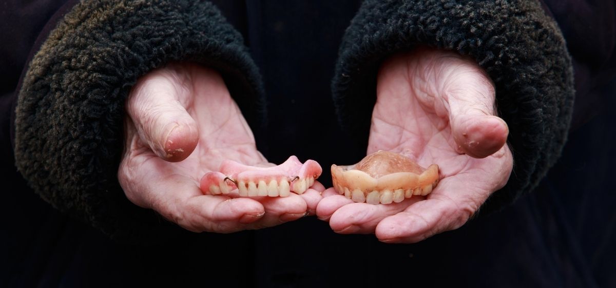 Apa itu Protesa Gigi? Pengertian & Fungsinya! | Blog Rey