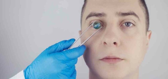 6 Ciri-Ciri Katarak dan Jenisnya, Haruskah di Operasi? | Blog Rey