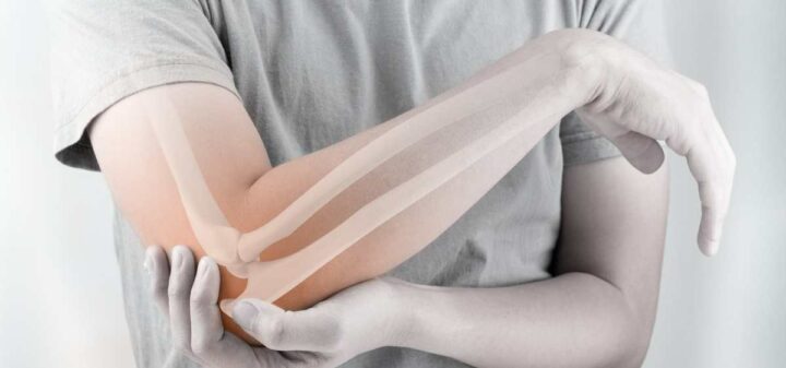 Apa Perbedaan Vitamin D dan D3? Fungsi dan Efek Sampingnya! | Blog Rey