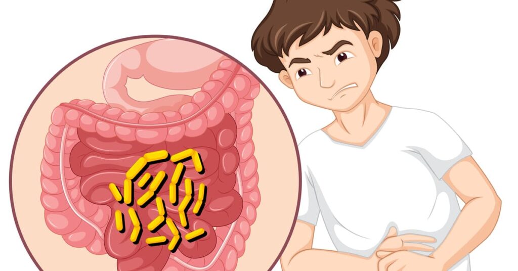 Apa Penyebab Cacing Kremi? Ini Penjelasannya! | Blog Rey