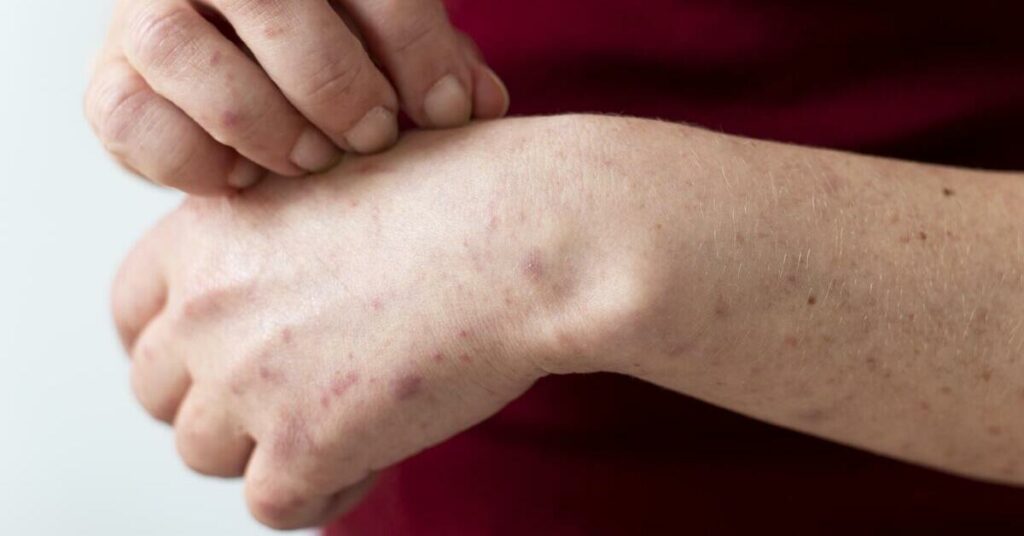 8 Gejala Penyakit Autoimun yang Perlu Diwaspadai | Blog Rey